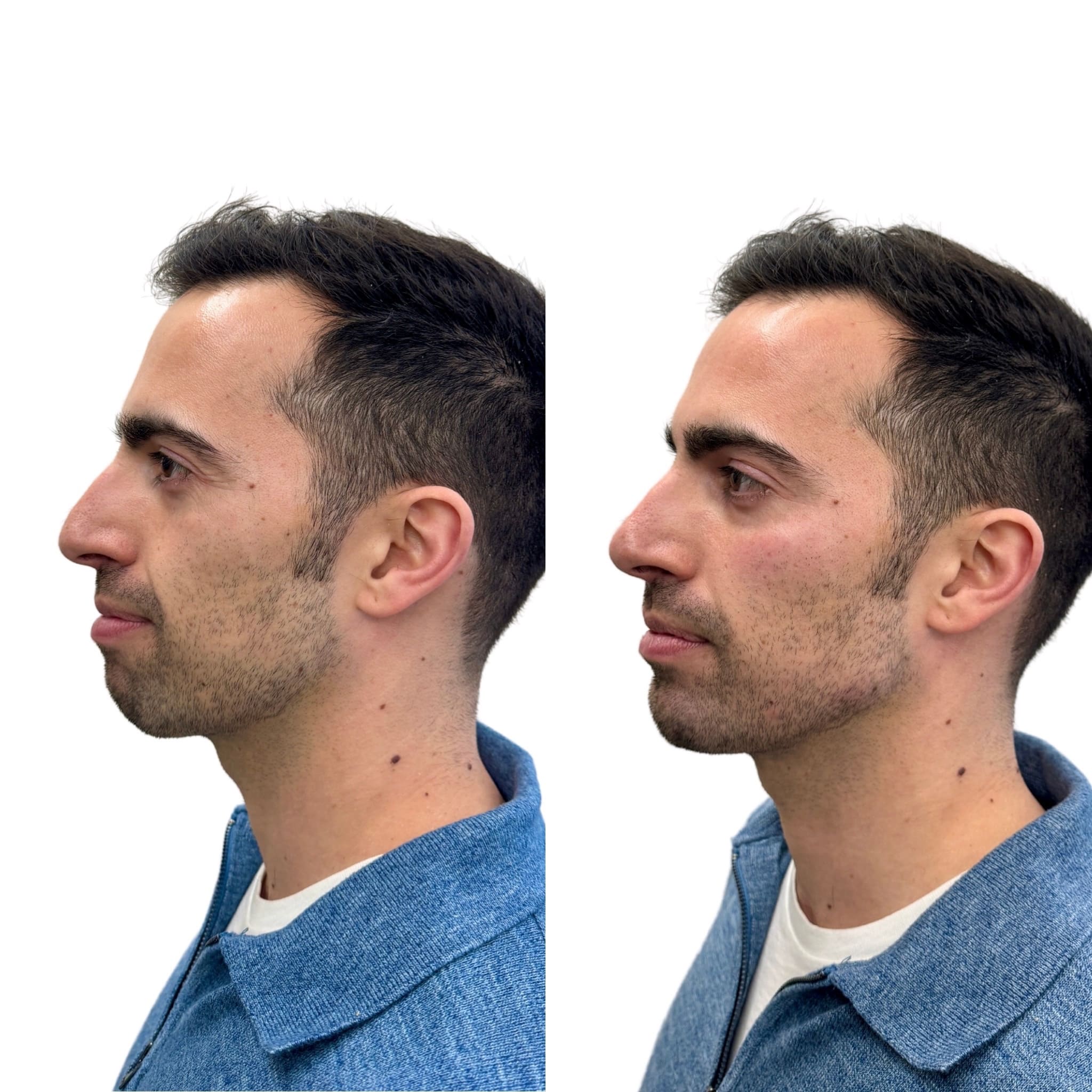 Facial Aesthetics | Aesthetic Clinic | JB Aesthetics